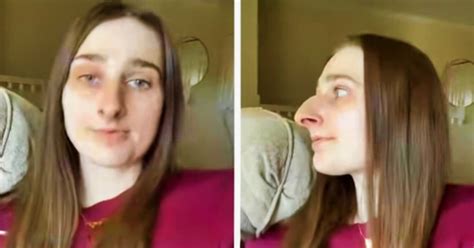 Meitene Kas Sapņoja Par Ideālu Degunu Viņas Deguna Plastikas Rezultāti Ir Pārsteidzoši