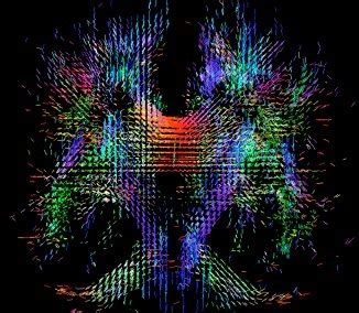 Diffusion Tensor Imaging Diffusion Imaging Introduction Tutorials And Background On