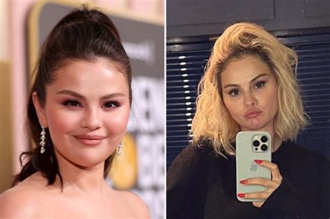 Selena Gomez Plastic Surgery Before And After