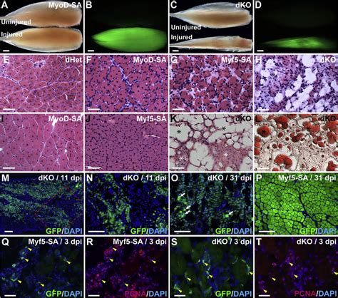 Whole Mount And Histological Analyses Of Skeletal Muscle Regeneration Download Scientific