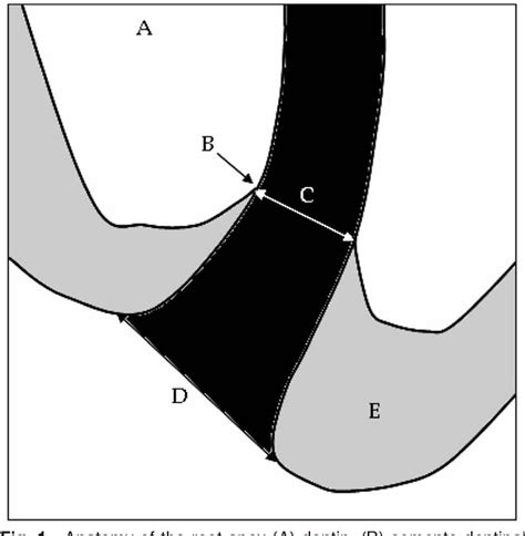 Figure 1 From Electronic Apex Locators —a Review Semantic Scholar