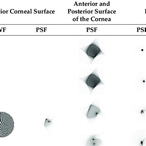 Wavefront And Corresponding Psf For A Cornea With Low Myopia Before And Download Scientific