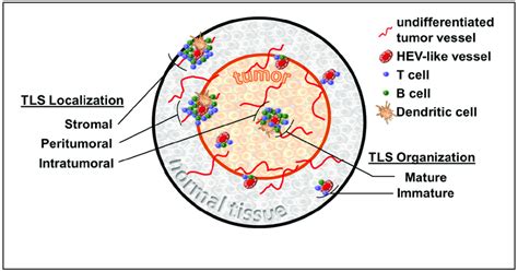 Tertiary Lymphoid Structures Tls Variably Present Within Surrounding