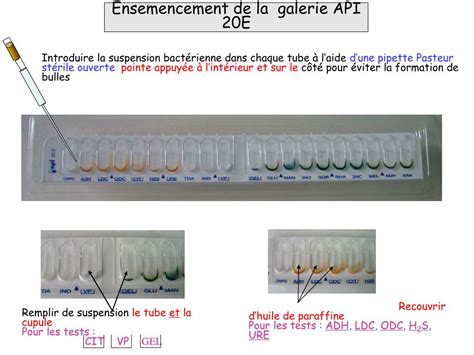 Ppt Galerie Api 20e Ensemencement Lecture Et Interprétation