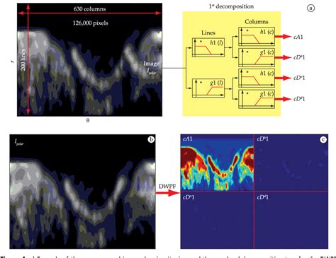 Figure 1 From An Approach To Automatically Segment The Media Adventitia Borders In Semantic