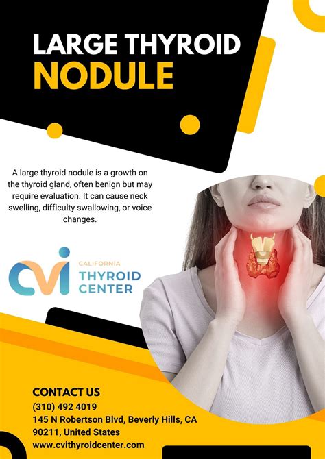 Thyroid Cyst Treatment Calfornia Thyroid Center Medium