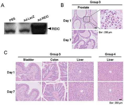 A Reic Protein Expression Following Intraprostatic Ad Reic Injection
