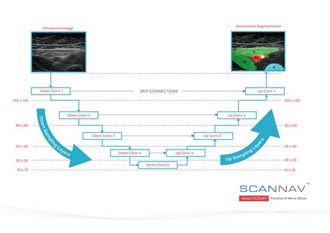 Artificial Intelligence For Ultrasound Scanning In Regional Anaesthesia