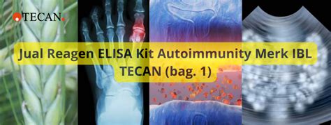 Jual Reagen Elisa Kit Autoimmunity Merk Ibl Tecan Bag 1 Pt Indogen