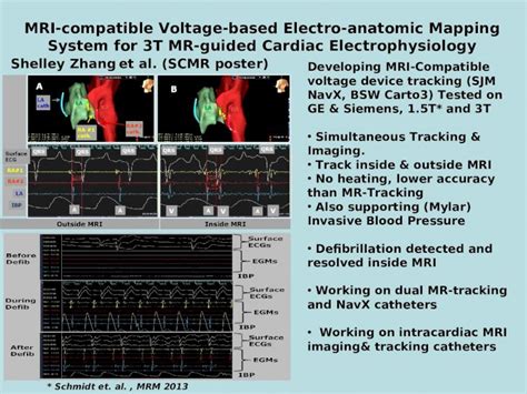 Ppt Mri Compatible Voltage Based Electro Anatomic Mapping System For 3t Mr Guided Cardiac