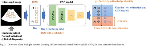 Figure 3 From Weakly Supervised Multiple Instance Learning For Liver