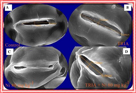 Scanning Electron Microscope Images Showing The Stomatal Behavior In M