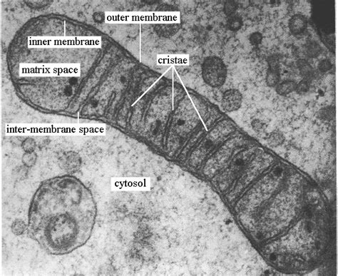 Mitochondria Electron Micrograph Labelled