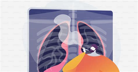 건강에 해로운 생활 방식 담배를 피우는 남자 흡연자 폐 손상 호흡기 질환 위험 니코틴 중독 유해한 습관 건강 위험 벡터 격리된 개념 은유 그림 벡터