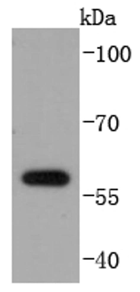 E2f1 Antibody Ma5 32476