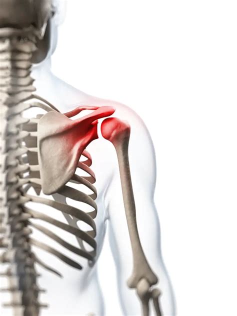 Rotator Cuff Injury Causes And Fixes