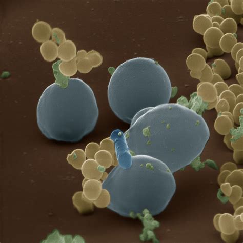 Lactic Acid Bacteria And Yeast Photograph By Eye Of Science Pixels