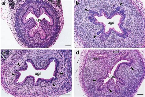 Prostatic Sinus
