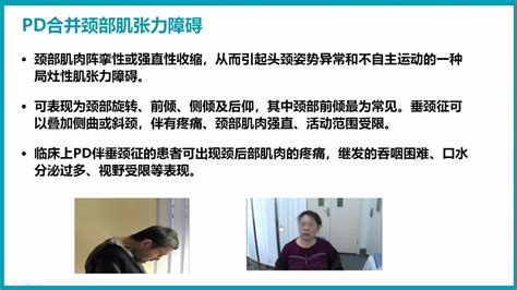 【学术报告整理】帕金森病伴肌张力障碍识别及治疗——大连医科大学附属第一医院功能神经中心李涛、梁战华教授分享 脑医汇
