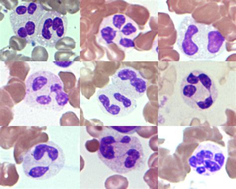 Segmented Neutrophils