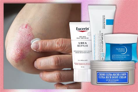 Best Creams For Psoriasis 2025 Recommended By A Dermatologist The