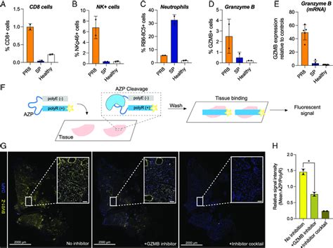 Gzmb Is Elevated In Viral Pneumonia And Contributes To Nanosensor