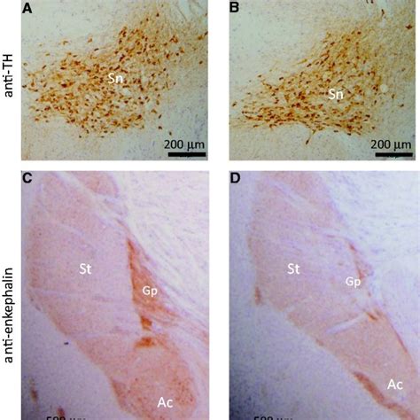 α Synuclein Pathology In Fibril Injected Mice Brain Was Immunoreactive
