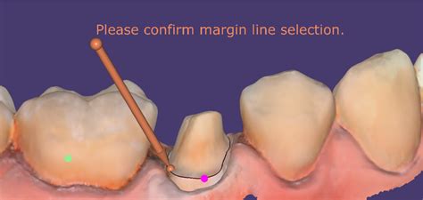 Annotation Editor Exocad