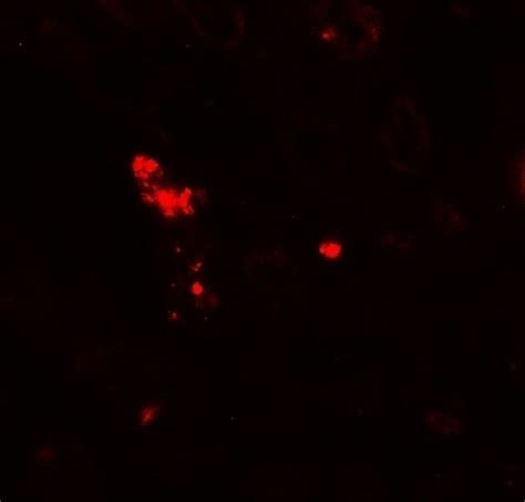 NOX3 Antibody - Cat. No. 7925 | ProSci
