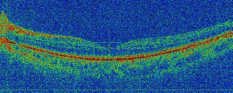 数字图像处理，图像的伪彩色处理图像伪彩色处理源代码 Csdn博客