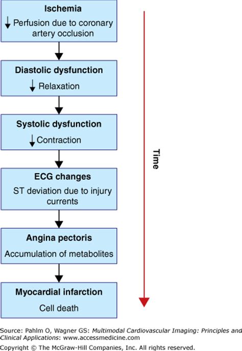 Electrocardiography Of Ischemic Heart Disease Radiology Key