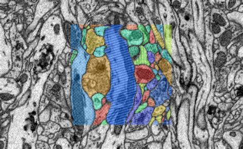 Annotation Techniques For Large Scale Volume Em Datasets By Norman Rzepka Webknossos Medium