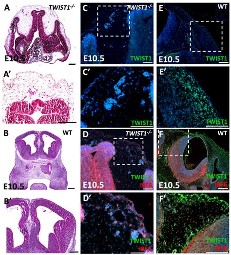 Fig S2 Validation Of Anti Twist1 Antibodies In Twist1 Null Embryonic