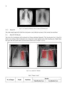 Pneumonia Detection In Chest X Rays Using Neural Networks DeepAI