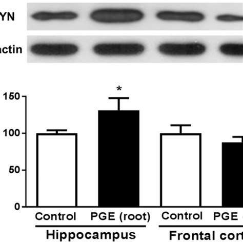 Immunoblotting Analysis Of Synaptophysin Expression In The Hippocampus Download Scientific