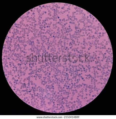 Close View Reticulocyte Count Under Microscope Foto Stock 2150414889