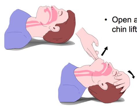 Basic Life Support Flashcards Quizlet
