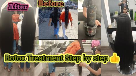 Botox Treatment Step By Step Process In Details YouTube