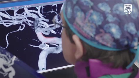 Chris Graeff On Linkedin Neuro Decisions Are Based On What You See So See More