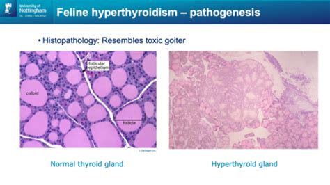 Physiology Of Hyperthyroidism Flashcards Quizlet