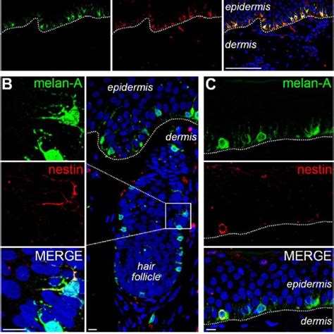 Pdf Tubb3 Neuronal Marker Or Melanocyte Mimic