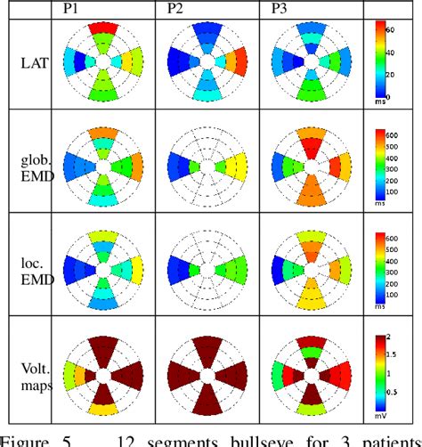Figure 1 From Spatio Temporal Registration Of Electro Anatomical Mappings With Functional Data