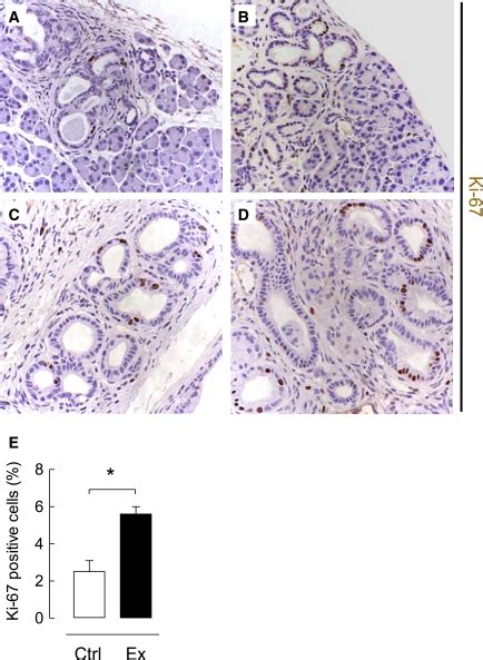 Duct Cell Replication Frequency Is Increased In The Pancreas Of