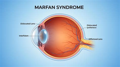 Crandall Eye Physicians And Surgeons Jesup Ga Eye Care