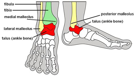 Broken Ankle Types Of Fractures Diagnosis And Treatments Hss
