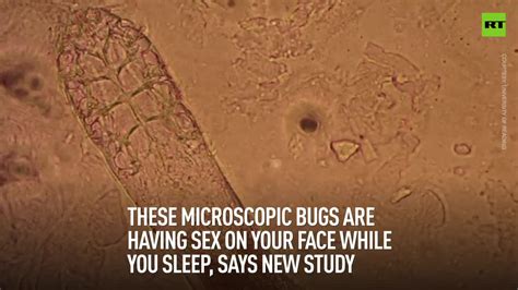 These Microscopic Bugs Are Having Sex On Your Face While You Sleep