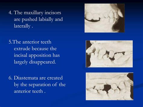 9tooth Mobilityppt Dental Health Diseases And Conditions