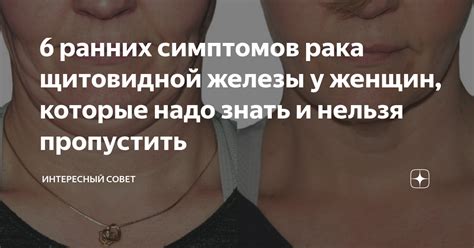 6 ранних симптомов рака щитовидной железы у женщин которые надо знать и нельзя пропустить