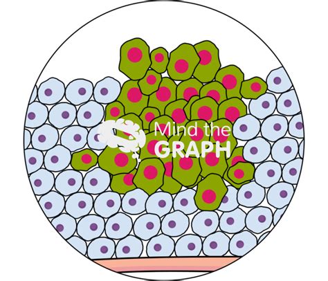 Free In Situ Cancer Icons Symbols Pictures And Images Mind The Graph