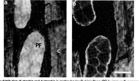 Figure 1 From Utrophin Localization In Normal And Dystrophin‐deficient Heart Semantic Scholar